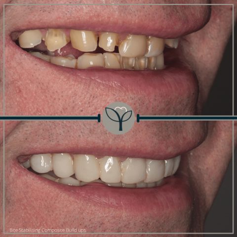 Smile Gallery: Cosmetic Dental Before and After Photos